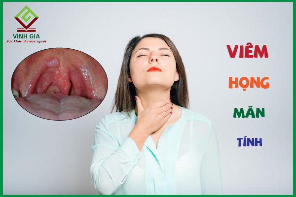 Viêm họng mãn tính và các phương pháp điều trị hiện nay