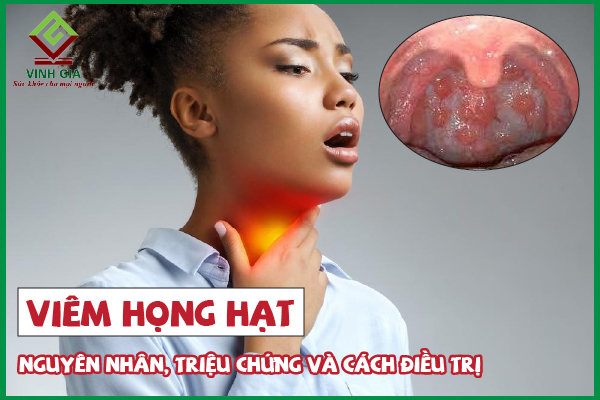 Viêm họng hạt: Nguyên nhân, dấu hiệu, phòng ngừa và điều trị