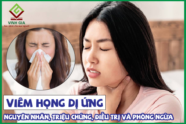 Những viêm họng kích ứng nguyên nhân và cách điều trị tại nhà
