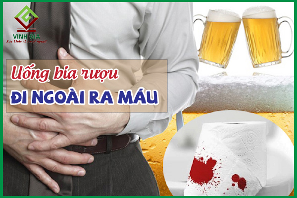 Cần làm gì khi uống bia rượu đi ngoài ra máu?